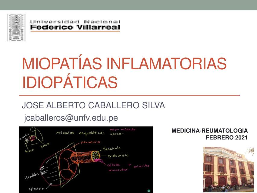 Miopatías Inflamatorias Idiopáticas | shadow | uDocz