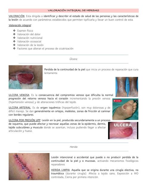 Valoración Integral de Heridas | Javiera Cuadras | uDocz