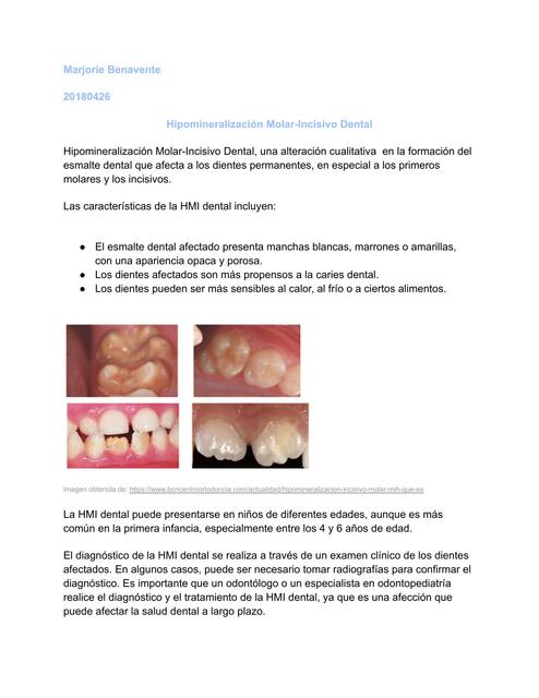 Hipomineralización Molar Incisivo Dental | Marjorie Marcela | uDocz