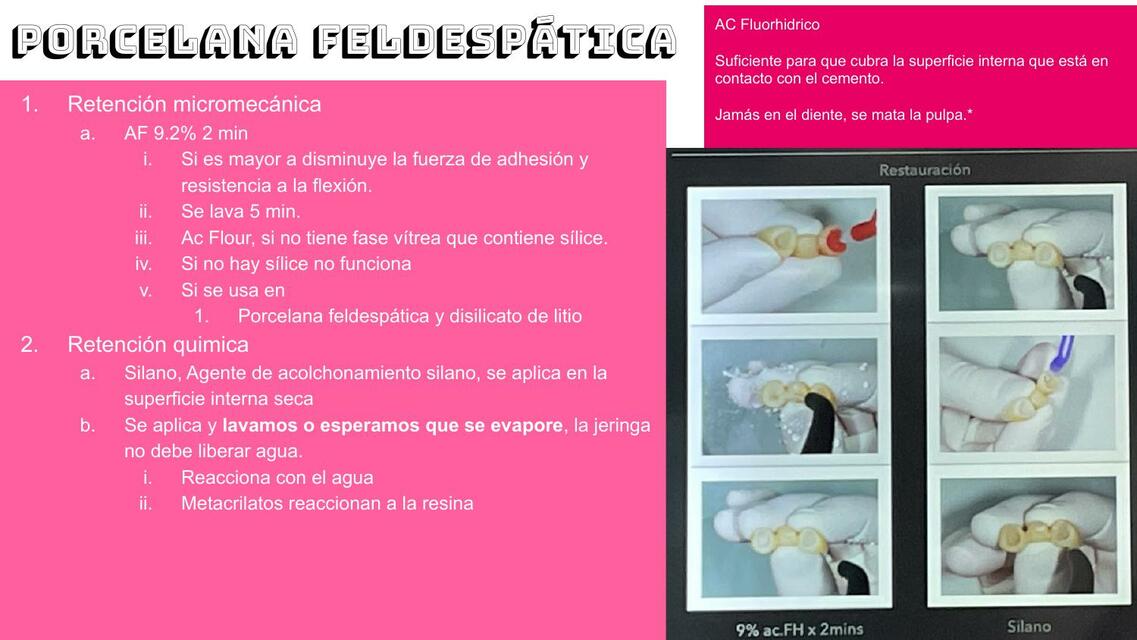 Protocolo Cementado Porcelana Feldespática | Marjorie Marcela | uDocz