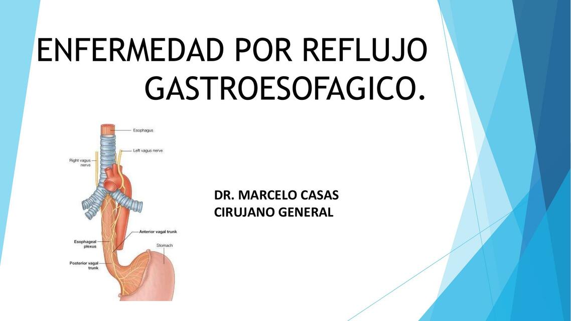 Enfermedad por Reflujo Gastroesofágico | Diego | uDocz