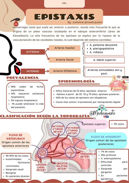 Epistaxis ORL | 💊Medicquests♡ | uDocz