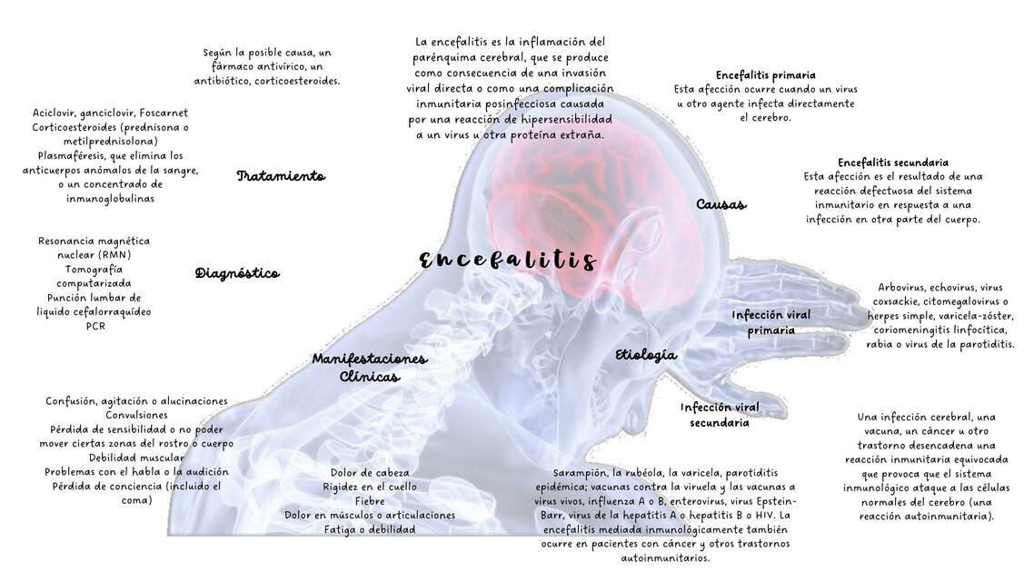 Encefalitis | Becka Villalobos Castillo | uDocz