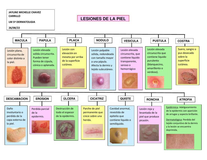 Lesiones de la Piel | Jayline Michelle Carrillo | uDocz