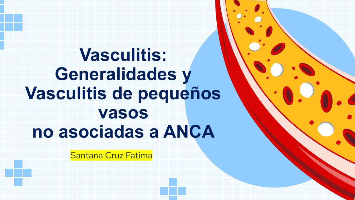 Vasculitis | Faty Santana | uDocz