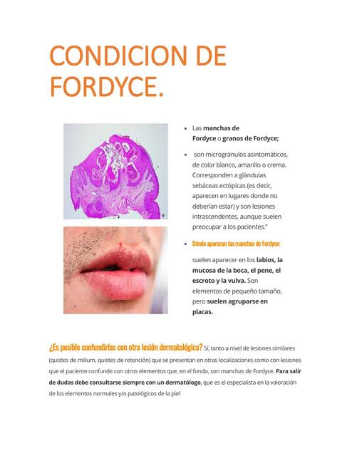 Condición de Fordyce | Fernanda GH | uDocz