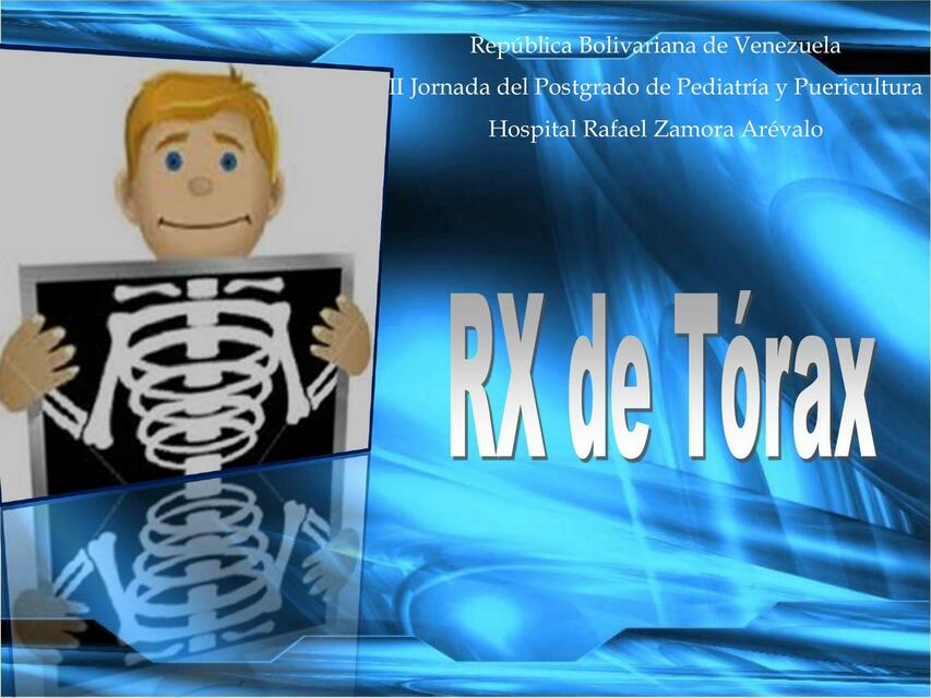 Resúmenes de Rx frontal | Descarga apuntes de Rx frontal