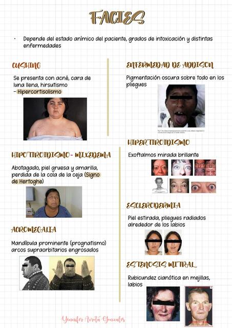 Resúmenes de Facies | Descarga apuntes de Facies