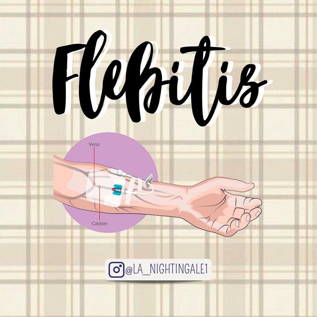 Flebitis | Linda Milena León Gómez | uDocz