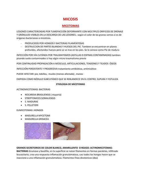Micosis: Micetomas, esporotricosis, cromomicosis, rinosporidiosis ...