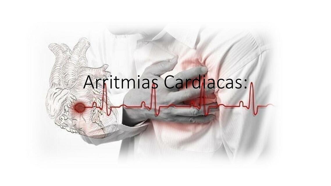 Arritmias Cardiacas | Jose Arciniegas | uDocz