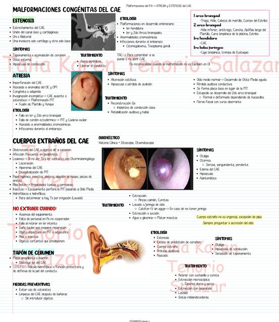 Malformaciones de Conducto Auditivo Externo | Talia Karen Tenorio ...