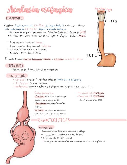 Acalasia esofágica | Medmafer_Study | uDocz