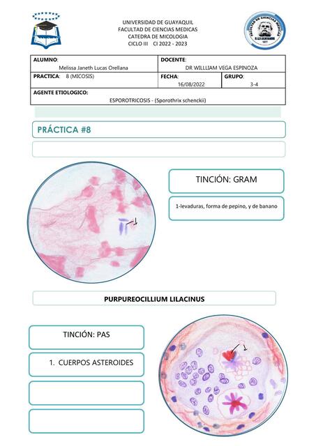 Micosis | Janeth Lucas | uDocz