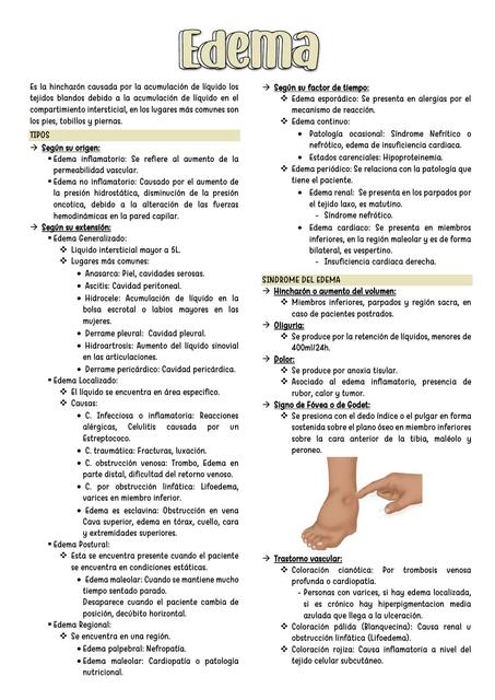 Edema | Linda Milena León Gómez | uDocz