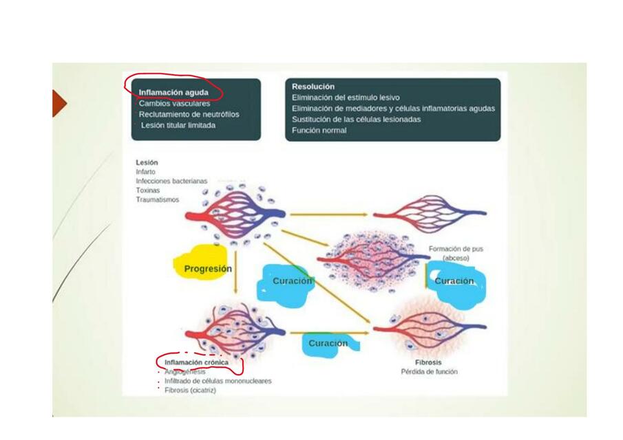 Síndrome De Respuesta Inflamatoria Sistémica | Tiroxina Med | uDocz