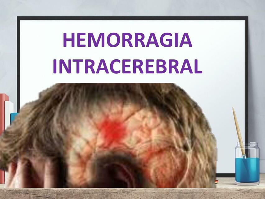 Hemorragia Cerebral | medicina eli | uDocz