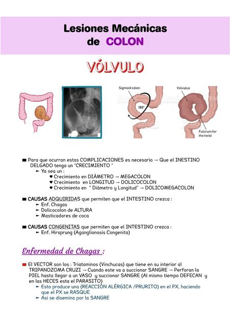 Lesiones Mecánicas e Inflamatorias del colon | Gabi | uDocz