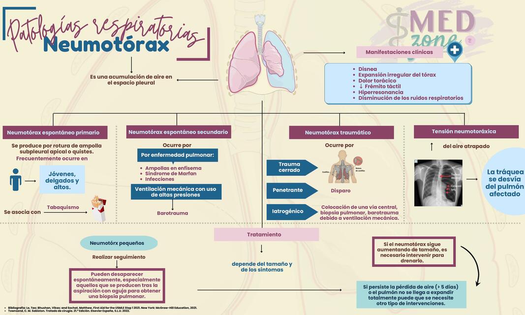 Patologías respiratorias: Neumotórax | Nataly Sarita | uDocz