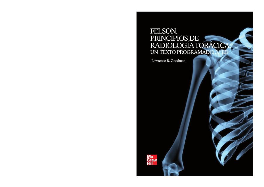 Principios de Radiología Torácica | ilan milstein | uDocz