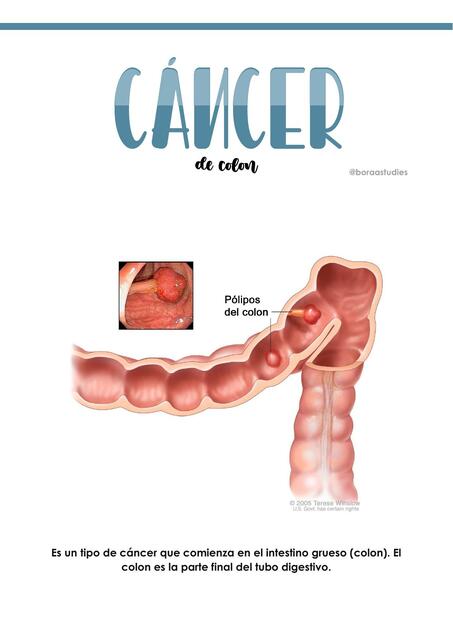 Cáncer de Colon | boraastudies | uDocz