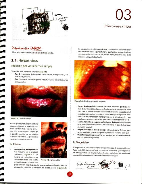 INFECCIONES VIRICAS DERMATOLOGIA | Lilibeth Zambrano | uDocz