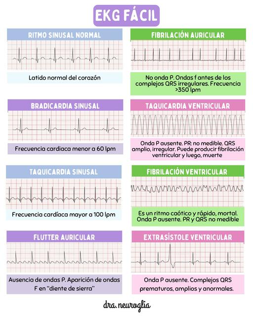 Electrocardiograma | Enfermería | uDocz