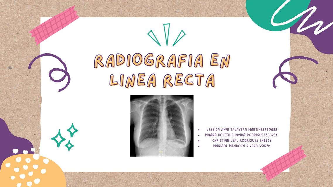 Radiografía en línea recta | Marisol Mendoza Rivera | uDocz