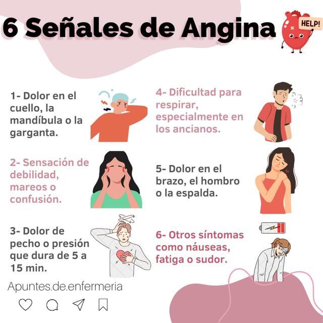 Señales de Angina | Apuntes.de.enfermeria | uDocz