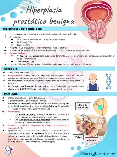 Hiperplasia Prostática Benigna | Med Jana sama | uDocz