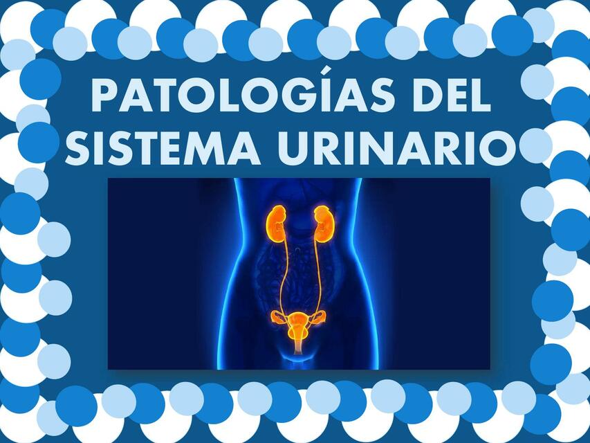 Patologías del Sistema Urinario | TakiStudy | uDocz