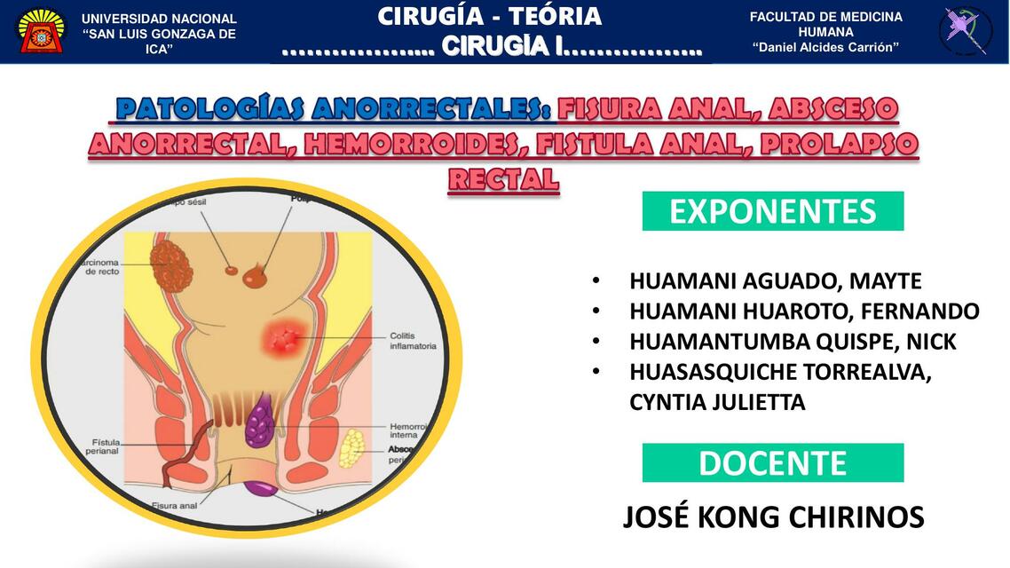 Patologías Anorrectales | CYNTIA JULIETTA HUASASQUICHE TORREALVA | uDocz