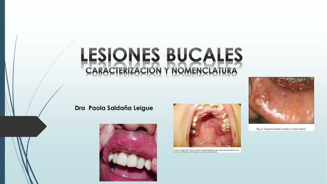 Lesiones Bucales | jose manuel | uDocz