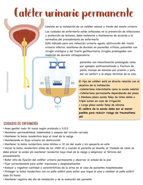 Tipos De Cateter Urinario Sondaje Vesical En Urgencias A Bordo Tipos De Cateter Urinario Sondaje Vesical En Urgencias A Bordo