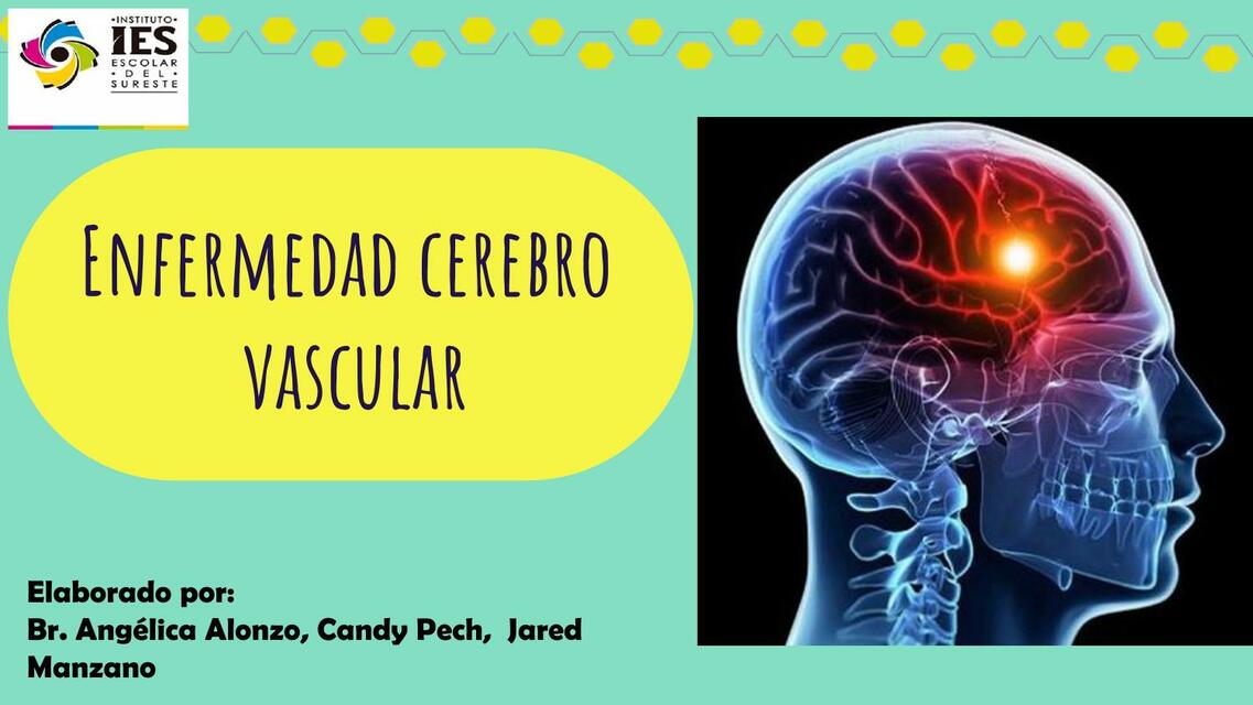 Enfermedad Cerebrovascular | Candy Itza | uDocz