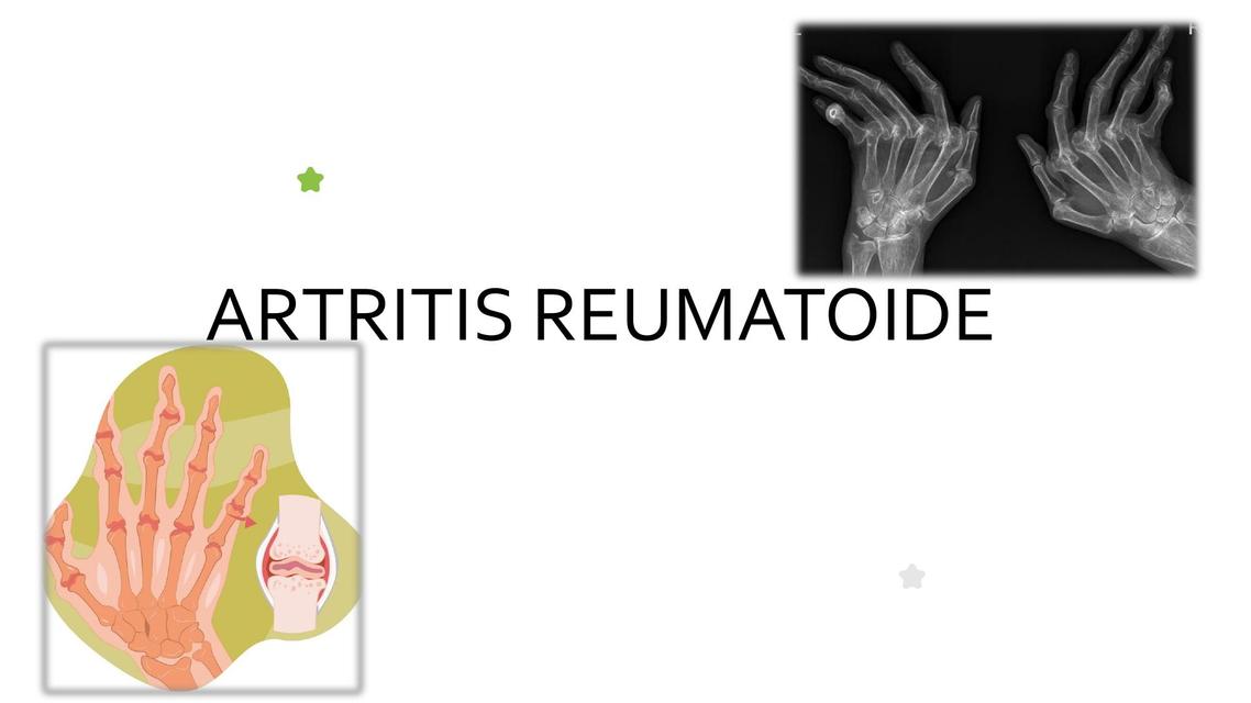 Artritis Reumatoide | SELENE OSORIO | uDocz
