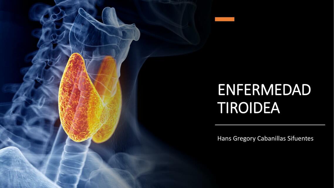 Enfermedad tiroidea | Hans Cabanillas | uDocz