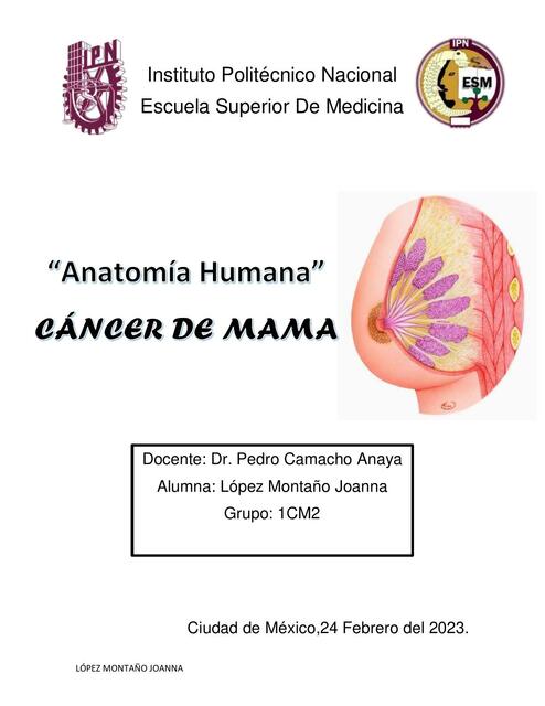 Cáncer de Mama | Joanna López | uDocz