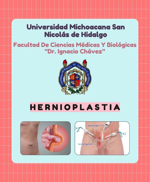 Hernioplastia | Javier Rios | uDocz