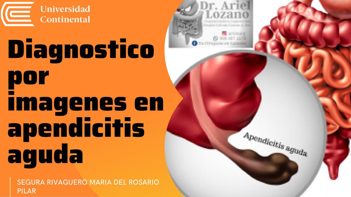 Apendicitis aguda | MARIA SEGURA | uDocz