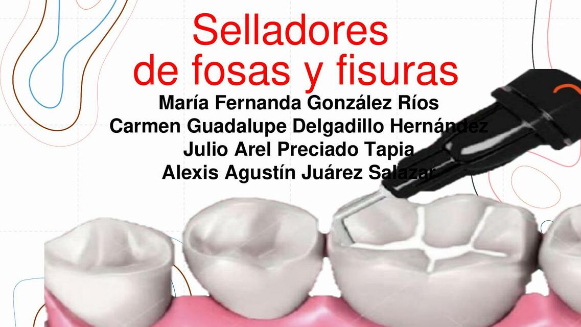 Sabes Que Es Un Sellador De Fosas Y Fisuras