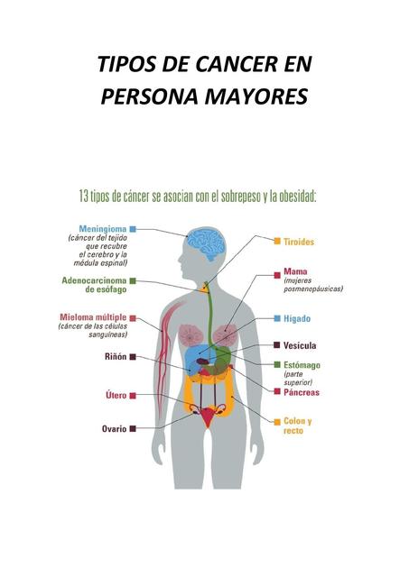 Tipos de cáncer en persona mayores | Yazmin Mejia | uDocz