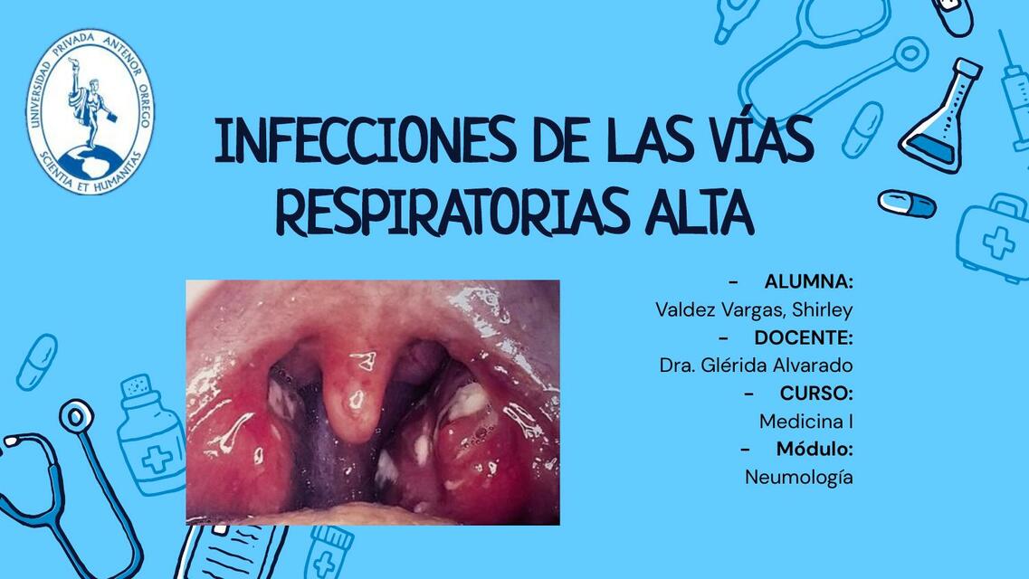 Inflamación de las Vías Respiratorias Altas | MAYRA ALEXANDRA CHIROQUE ...