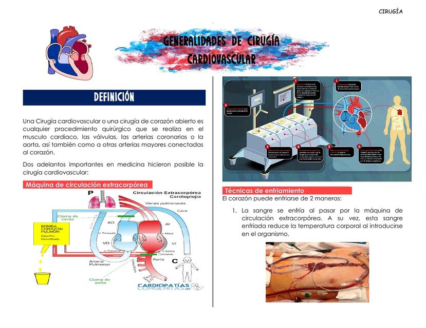 Generalidades de cirugía cardiovascular | uDocz