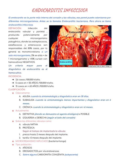 Endocarditis infecciosa | uDocz