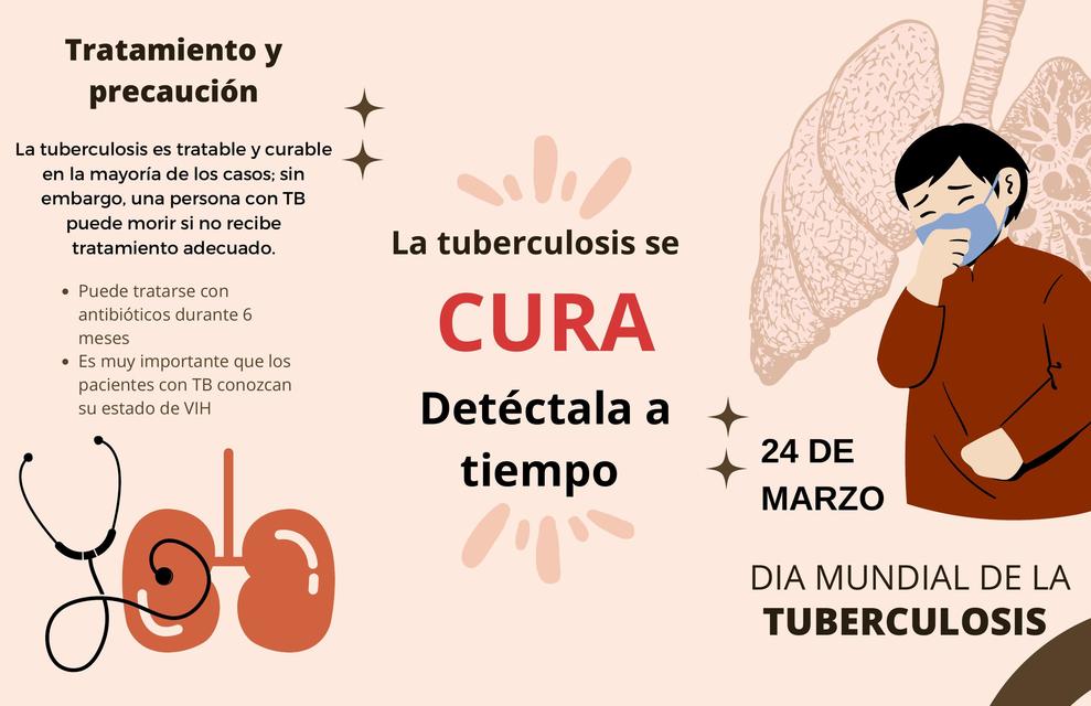 Tuberculosis | Karla Guadalupe | uDocz