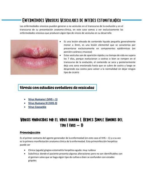 Virosis Vesiculares De Interés Estomatológico | Ameli | uDocz