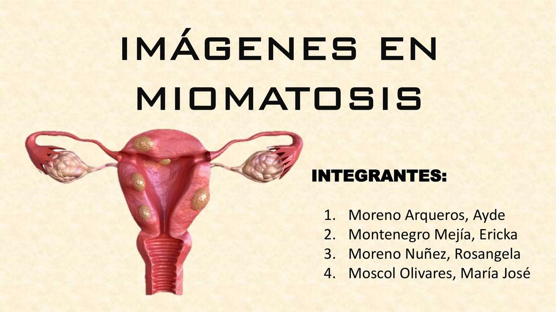 Imágenes en Miomatosis | ADA MORA | uDocz