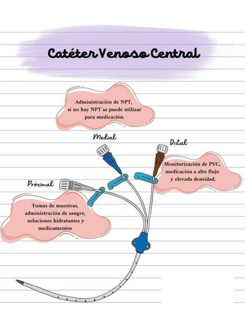 Catéter Venoso Central | Enfermero Isaias Rivas | uDocz