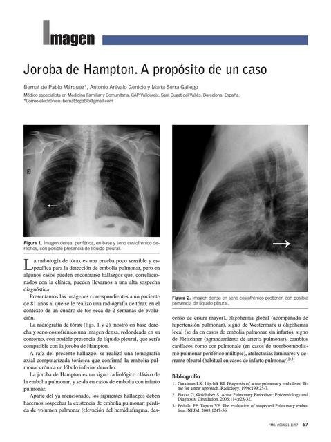 Joroba de Hampton | apuntesmedicos1 | uDocz
